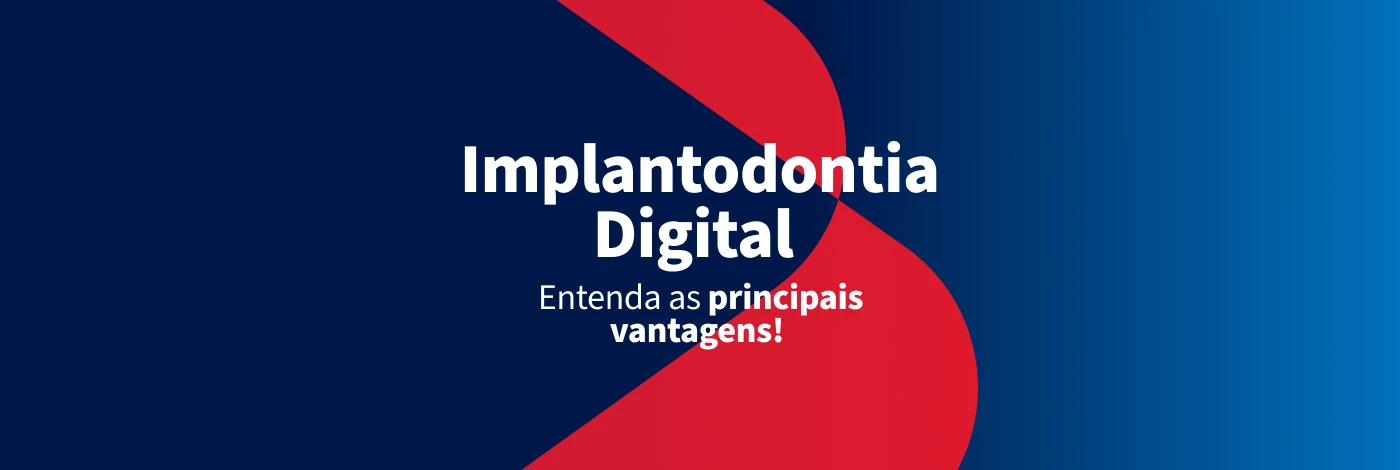 Fluxo digital na Implantodontia: 5 motivos para aderir
