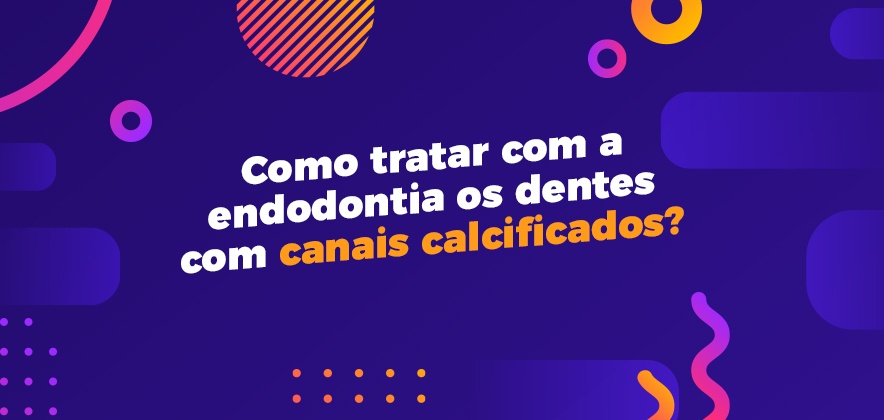 Canal calcificado: Possíveis tratamentos, quais as causas