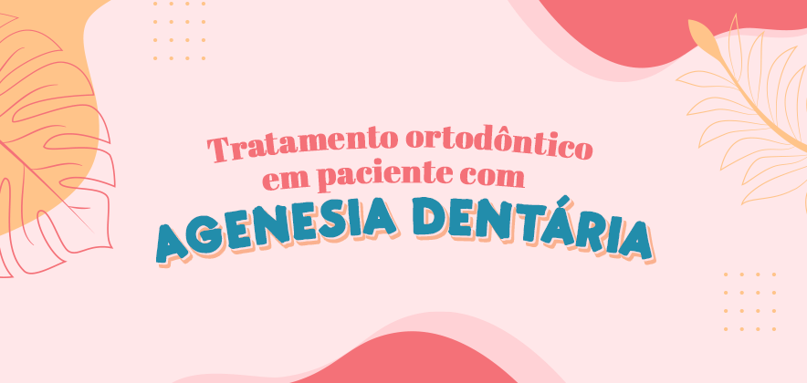 Agenesia Dentária: Como Tratar na Ortodontia