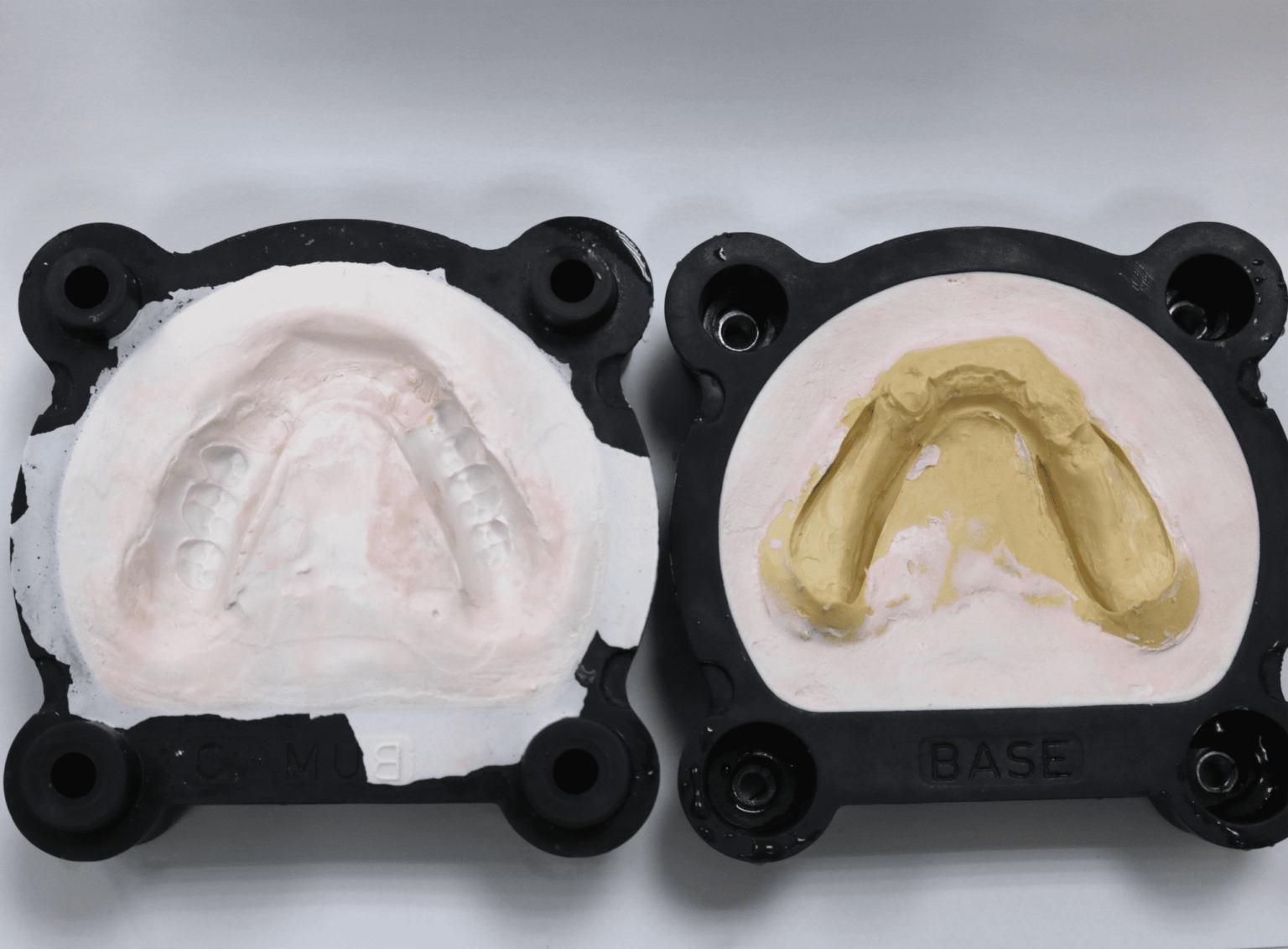 Mufla e sua utilização para inclusão de próteses acrílicas